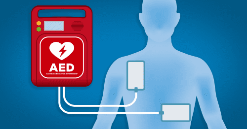 The Importance Of AEDs In The Workplace | Skills Training Group